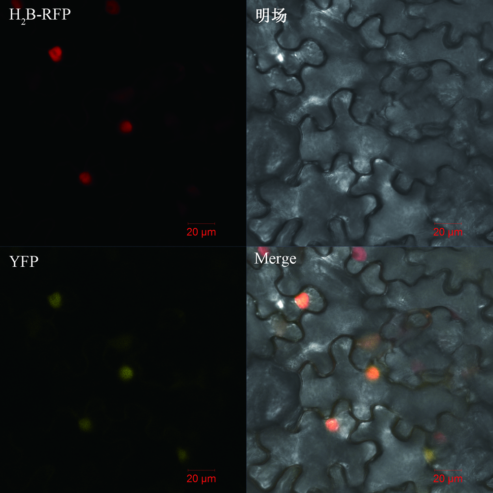 不结球白菜 BrABF 1基因的克隆与功能分析